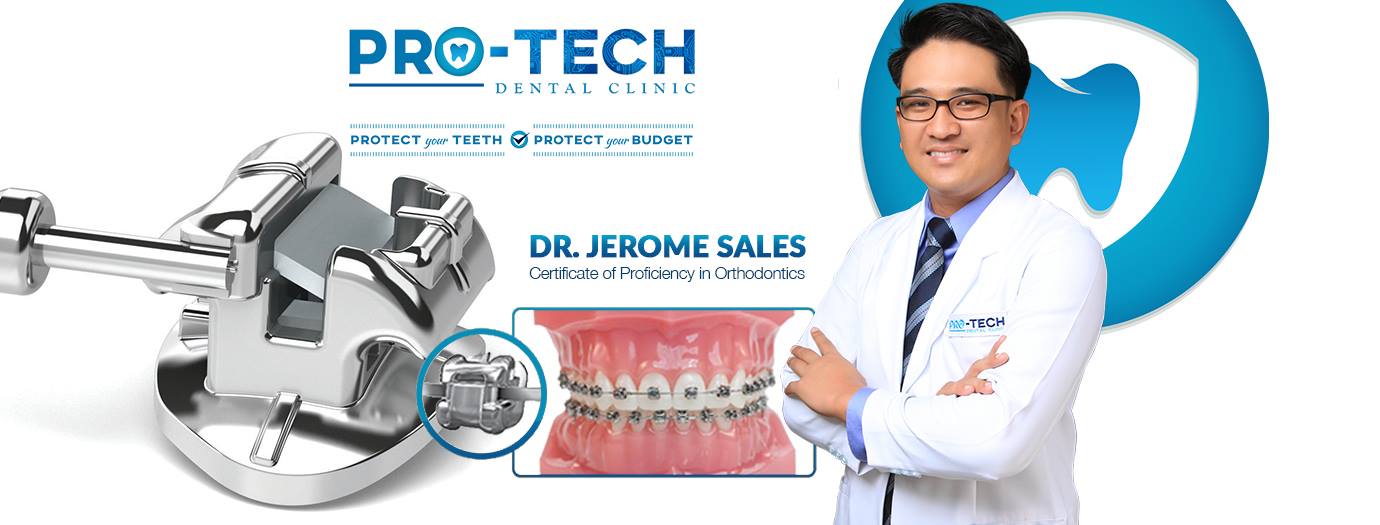 Pro - Tech Dental Clinic - Tecson St Adjacent to OLD BENECO Building, Baguio / Cosmetic Dentist ...